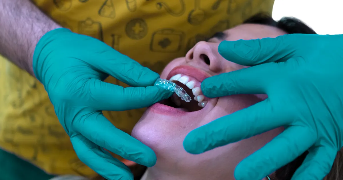 Ortodonti Tedavisi - Sıkça Sorulan Sorular - Myra Dental · Ağız ve Diş ...